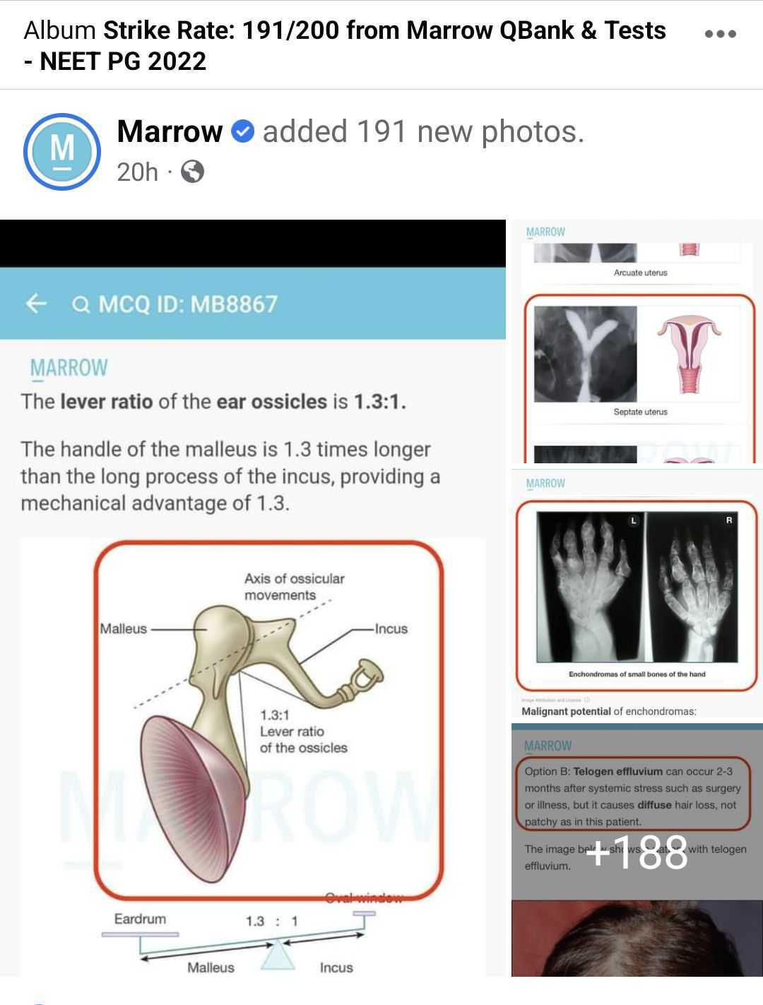Marrow Strike Rate in NEET PG 2022: 191/200 (QBank + Tests) |190/200 ...